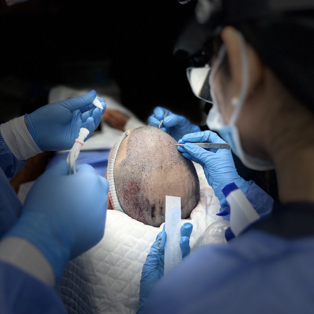 Spiro Hair Restoration Center revoluciona el trasplante capilar en ...